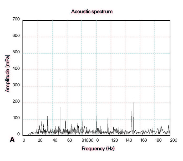 Acoustic monitoring and background noise in industrial environment ...