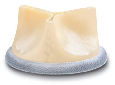 Bioprotesi valvolare aortica in pericardio - Tecnica Ospedaliera